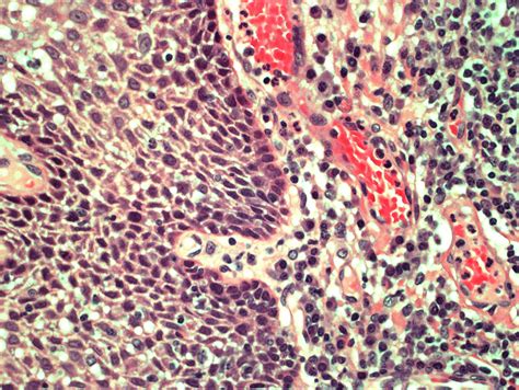 Reactive Lymph Node Germinal Centers Stock Image C012 1399 Science Photo Library