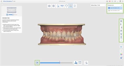 📖 Workflow Animation View Medit Help Center
