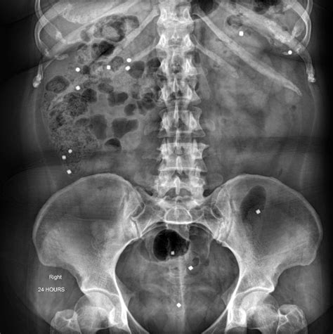 Image Radiopaedia Org