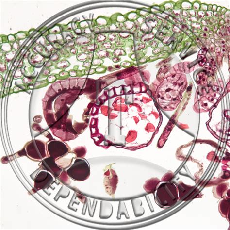 Polypodium Virginianum Leaflet Cs Attached Sporangium Prepared