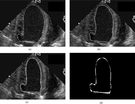 Comparison Between Manual And Automatic Contour Tracking The Initial Download Scientific