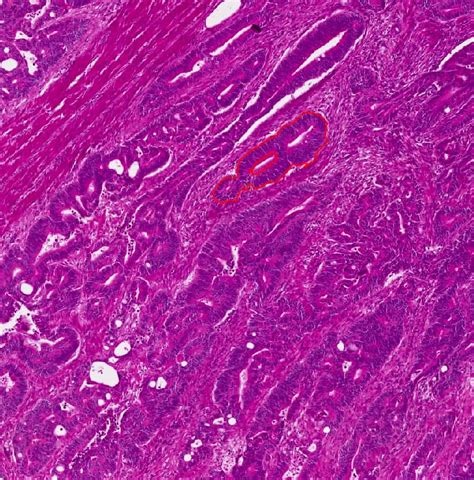Transferring Cell Detection Across Images Image Analysis Imagesc Forum