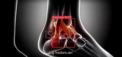 Dandu Vishnavi On Linkedin Artificialintelligence Objectdetection