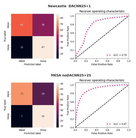 Confusion Matrices And Roc Auc On Top The Confusion Matrix And Download Scientific Diagram