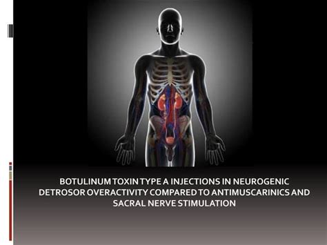 Botulinum Toxin Type A Injections Ppt