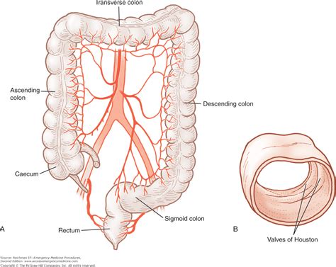 Chapter 71 Rigid Rectosigmoidoscopy Emergency Medicine Procedures 2e Accessemergency