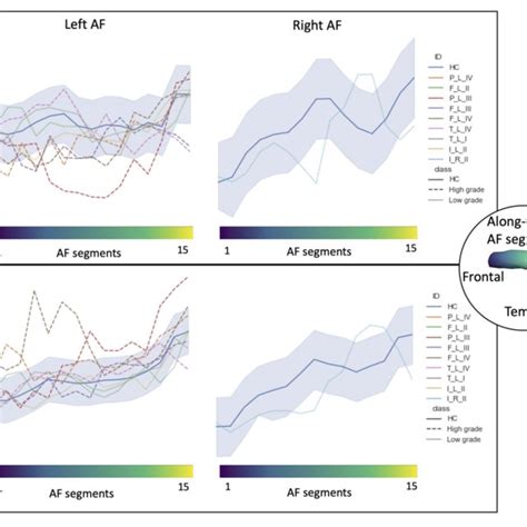 Along Tract Diffusion Tensor Imaging Dti Measures A Fractional Download High