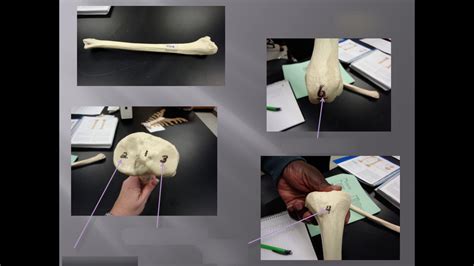 Tibia Diagram Quizlet