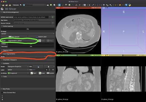 Model Not Found Under Auto Segmentation Tab In 3d Slicer · Issue 1332 · Project Monai
