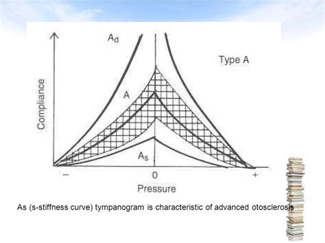 Otosclerosis Tympanogram