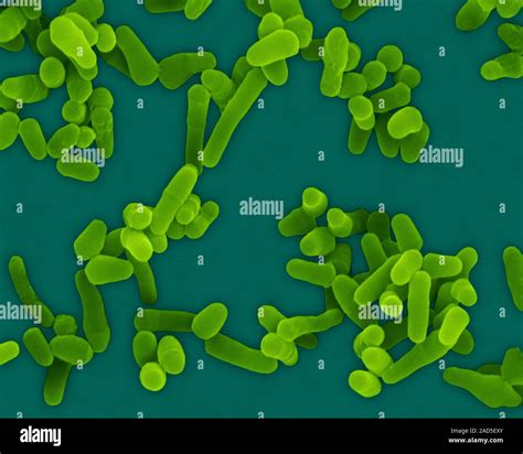 Coloured Scanning Electron Micrograph Sem Of Mycobacterium Avium Rod Prokaryote Dividing