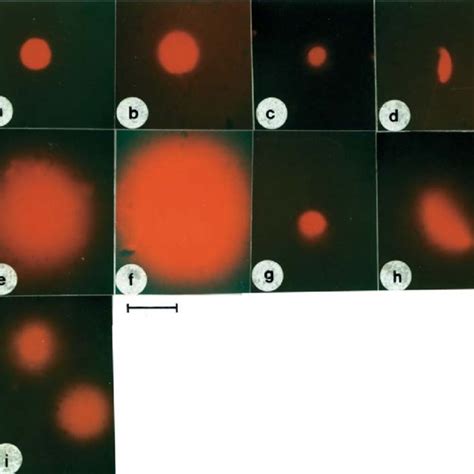 Radial Loops In Metaphase Chromosomes In The Radial Loop Model Of