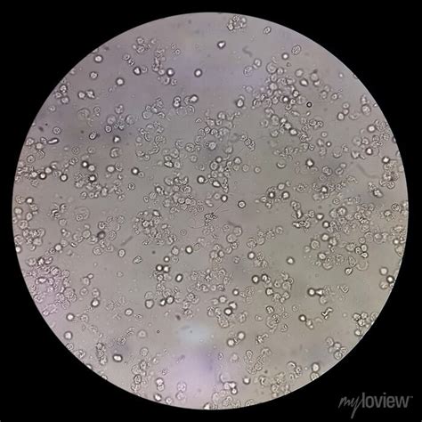 Sperm Morphology Semen Photo Under Microscope Micrograph Showing