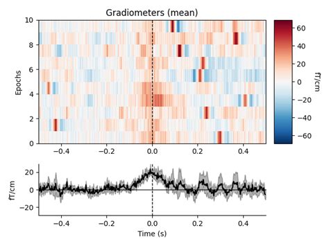 Overview Of Artifact Detection — Mne 1 0 3 Documentation