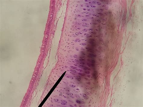 复层柱状上皮光镜图光镜图第2页大山谷图库