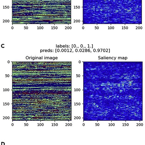 Classification Of Schizophrenia Diagnosis And Prs Class By Set I Snps