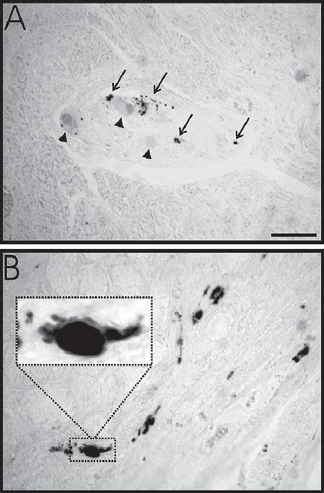Examples Of Synuclein Pathology In The Gi Tract A Synuclein Neuritic