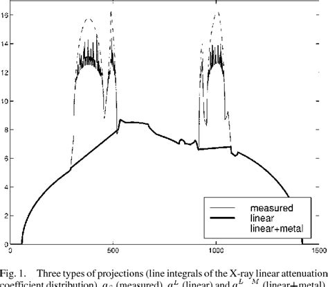 Figure 1 From X Ray Ct Metal Artifact Reduction Using Wavelets An Application For Imaging Total