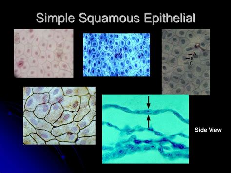 Ppt Simple Squamous Epithelial Powerpoint Presentation Free Download Id 3093896