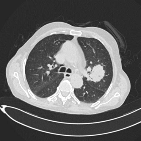 Brain Tumor Classification Object Detection Model V2 2024 10 31 701am By