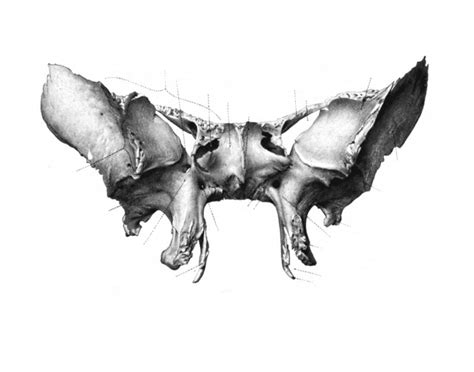 Sphenoid Bone Anatomy Quiz