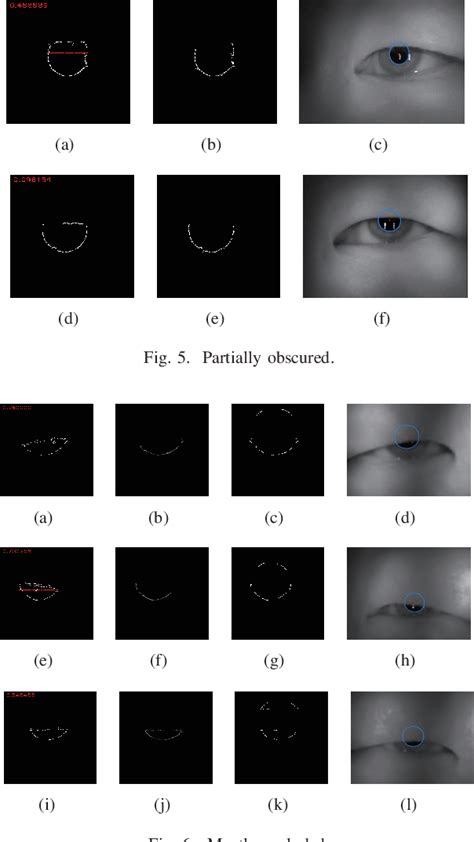 Figure 5 From A Pupil Localization Method Based On Dual Threshold And Contour Compensation