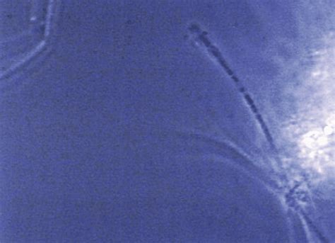 Phenol Control And Filament Reduction Saves 5000 Per Day Envirozyme