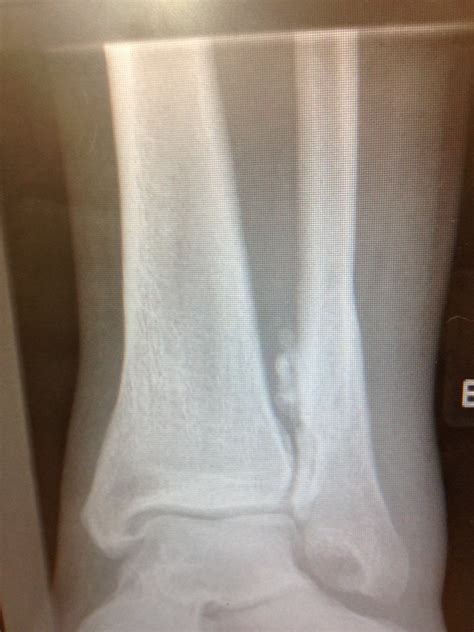 any doctors want to tell me whats wrong with my ankle r medical