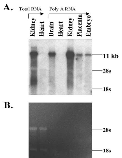 Detection Of Slc5a3 Transcripts In Total Rna And In Polya Rna From Download Scientific Diagram