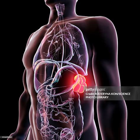 Polysplenia Illustration High Res Vector Graphic Getty Images
