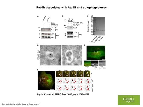 Rab7b Associates With Atg4b And Autophagosomes Ppt Download