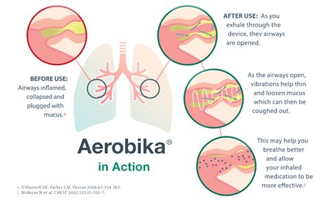 Aerobika Dispositif Naturel Opep De Dégagement Du Mucus Et Du Flegme