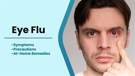 What Is Eye Flu Symptoms Precautions And At‑home Remedies