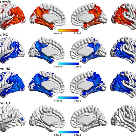 Group Comparisons Of The Whole Brain Gray Matter Volume A Comparison