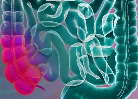 A Beginners Guide To Inflammatory Bowel Diseases Ibd Hub Organoids