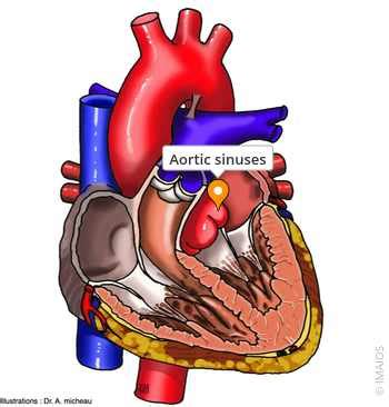 Aortic Sinuses E Anatomy Imaios