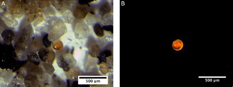 Suspected Orange Microbead And Sand Isolated From The Exposed Beach