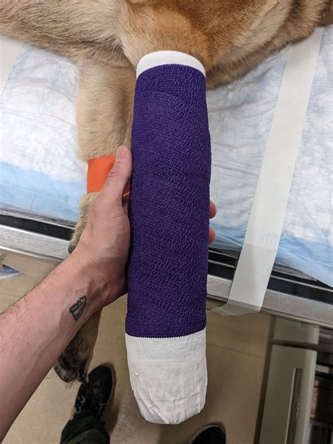 Modified Robert Jones Bandage Brians Bandages