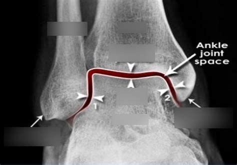 Diagram Of Ankle Anatomy Labelling Quizlet
