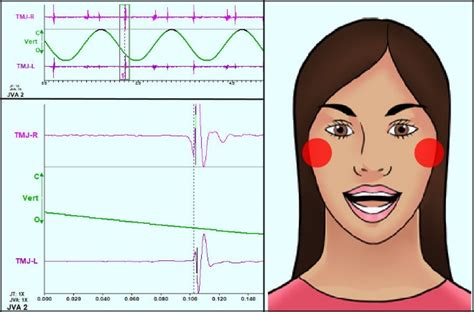 Comparison Of The Joint Vibration Analysis Jva Flow Chart To Mr Imaging Combined With Cbct