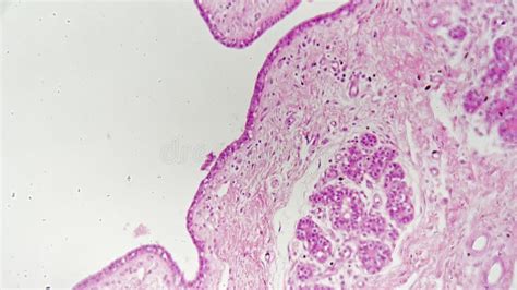 Mammary Gland In Stasis Filmed Under Microscope 400x Against Bright