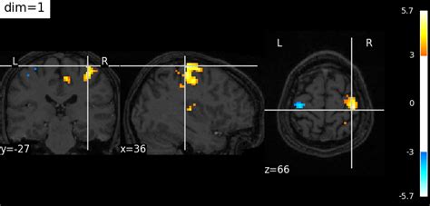 Controlling The Contrast Of The Background When Plotting Nilearn