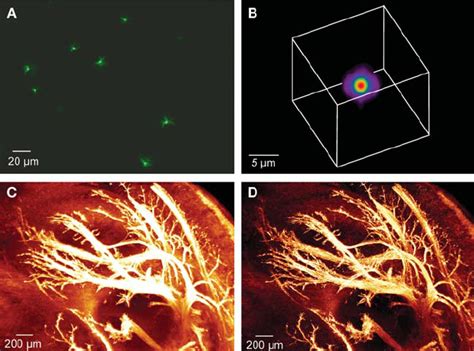 Quality Improvement Of Um Reconstructions By Nonblind Deconvolution