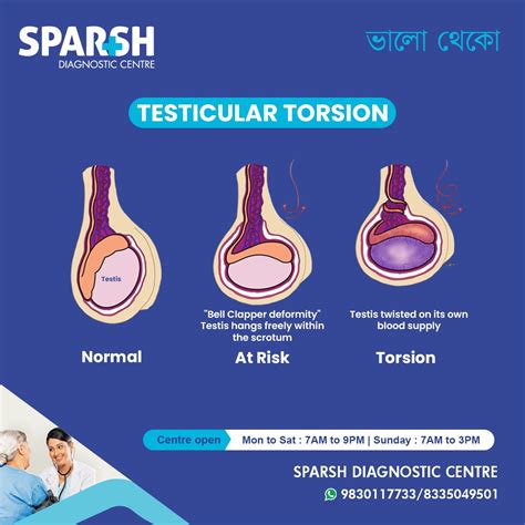 Testicular Torsion Sparsh Diagnostic Center