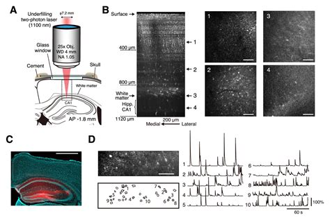 Two-photon calcium imaging of the medial prefrontal cortex and hippocampus without cortical ...