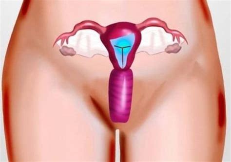 කන්‍යා පටලය නැවත සැකසීම හා ලිංගිකත්වය