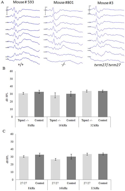 A Representative Abr Waveforms In Response To 16 Type 593