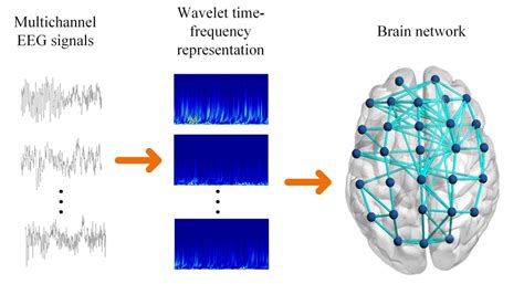 Schematic Of The Brain Network Construction Download Scientific Diagram