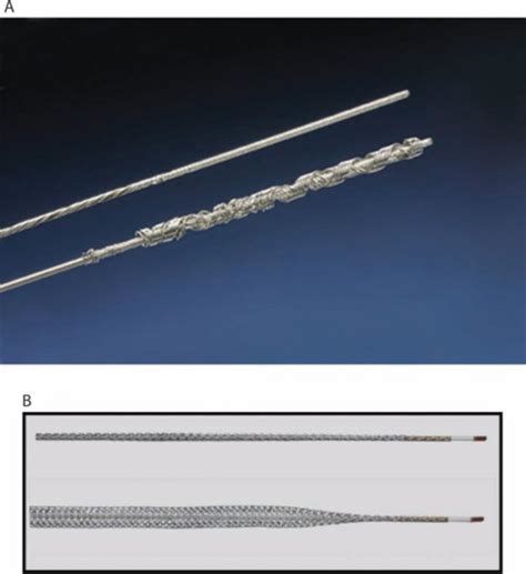 Strategies For Transvenous Lead Extraction Procedures PMC