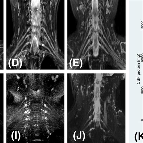 Brachial Plexus Mri Of Anti‐nf186 Patients And Csf Protein Level Of Download Scientific
